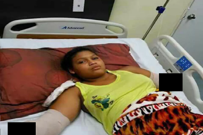 Adolescente amputada de ambos brazos tras recibir múltiples machetazos ...