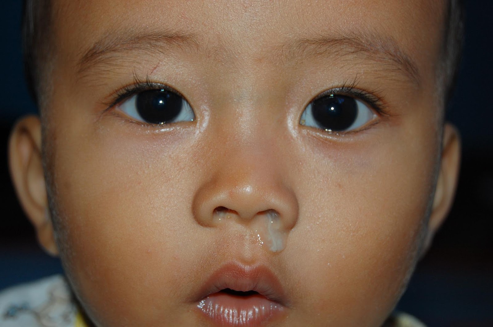 Tahukah Kamu? Ingus adalah cara tubuh membuat kita sembuh