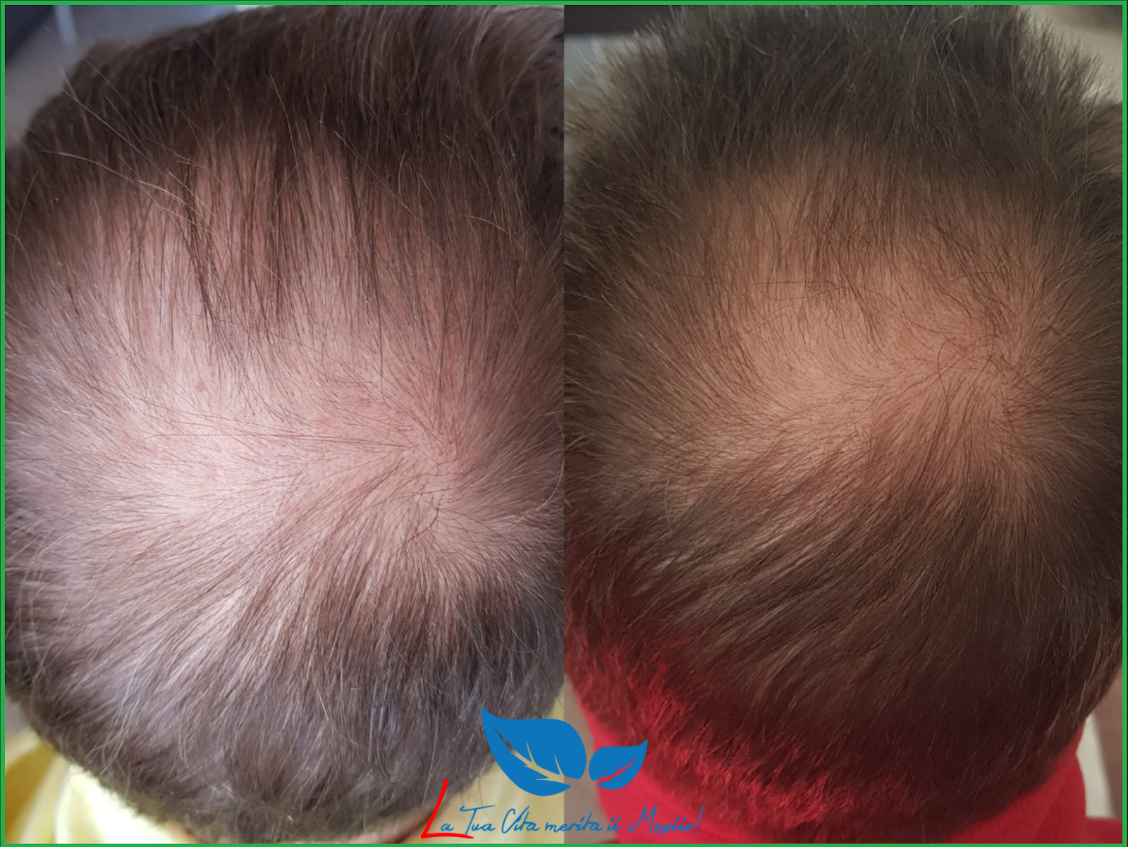 Rinforza e fai ricrescere i capelli con: