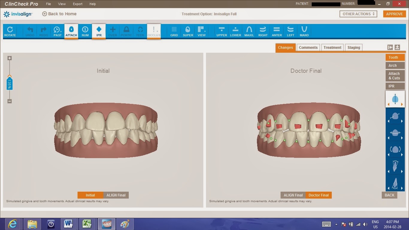 Your Markham Orthodontist, Toronto Invisalign, and Richmond Hill Braces ...