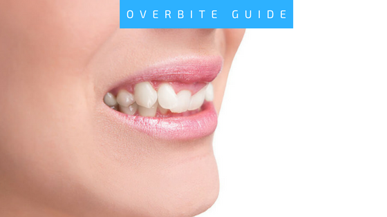 A Complete Overbite Guide: Causes and Treatments