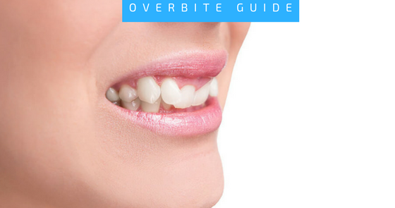 A Complete Overbite Guide: Causes and Treatments