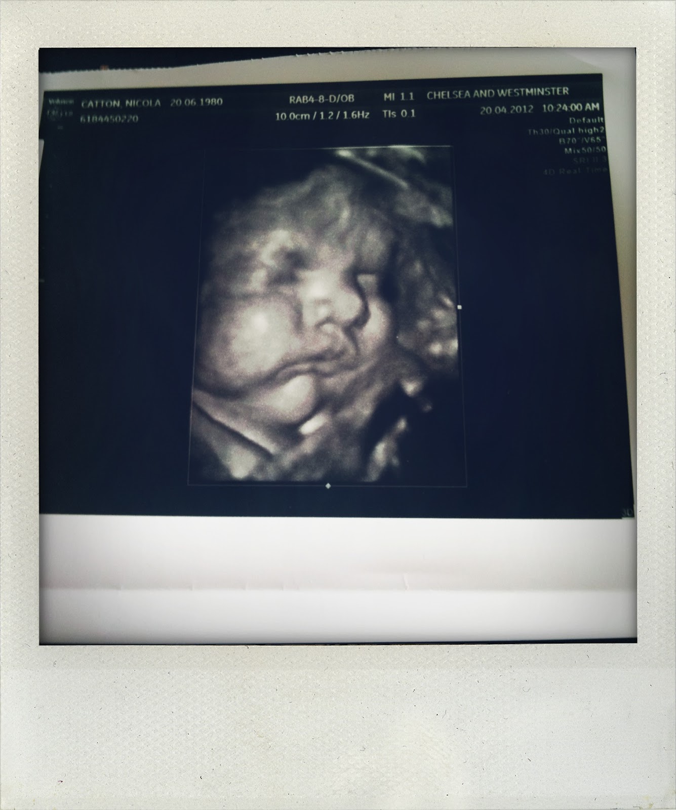Duffy's Diary...: 30 Week Scan