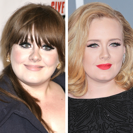 Adele Plastic Surgery