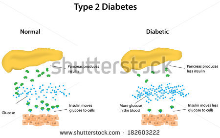 definición de diabetes, que es la insulina y como afrontar su diagnostico