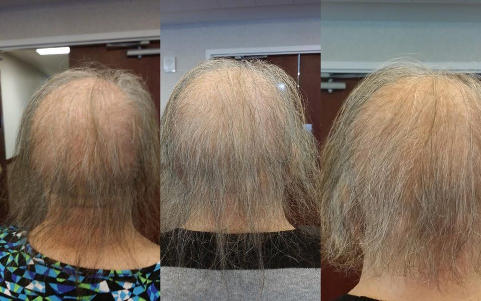 MONAT Global Revolutionary Hair Care Products: Is your hair thinning or ...