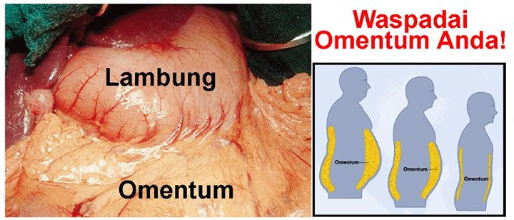 Waspadai Kelebihan Omentum Alias Lemak Perut - Generasi Biologi