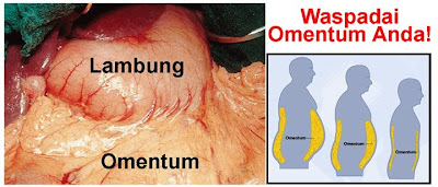 Waspadai Kelebihan Omentum Alias Lemak Perut - Generasi Biologi