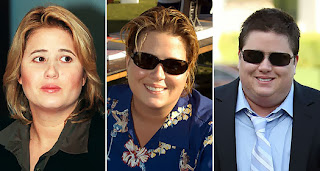 Chaz Bono Before And After Sex Change | plasticsurgerybeforeandafter