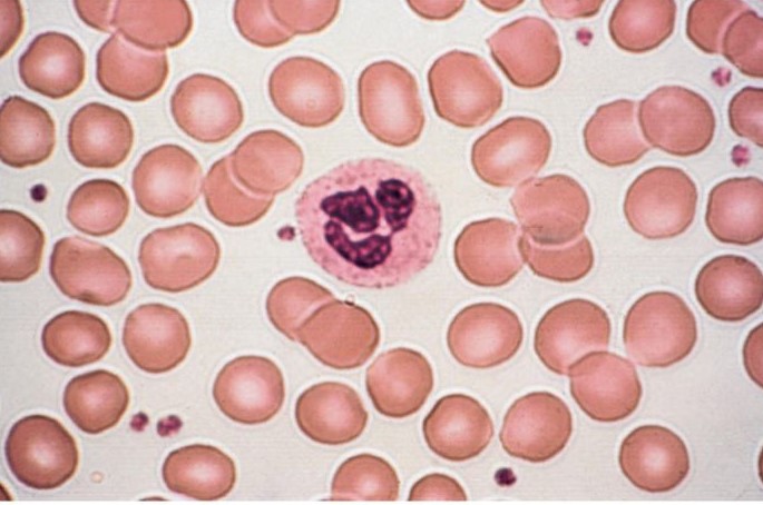 Carlos-Hema - Uribarri 2020 : TINCIÓN DE WRIGHT