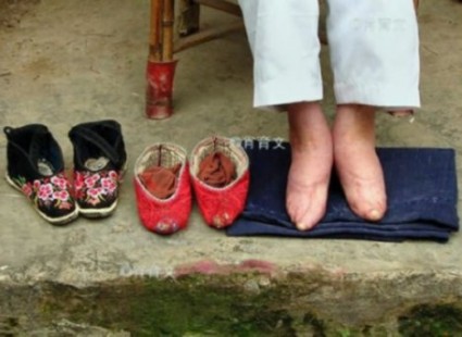 Wonderful World: Chinese Foot binding