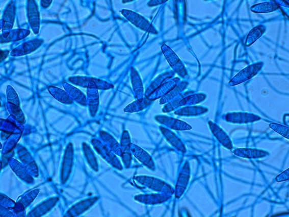 Fun With Microbiology (What's Buggin' You?): Microsporum gypseum