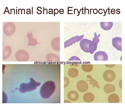 Medical Laboratory and Biomedical Science: Red Cell Morphology