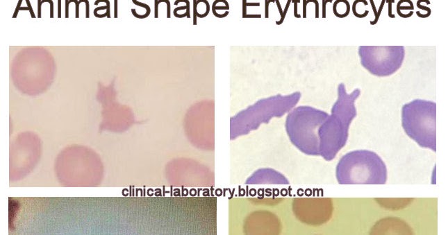Medical Laboratory and Biomedical Science: Red Cell Morphology