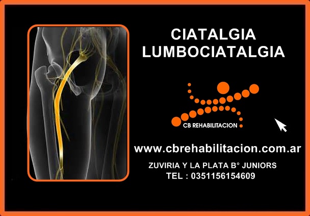CARLE BARON REHABILITACION: COLUMNA :CIATALGIA , CIATICA