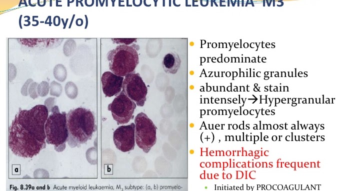 MY world MY story: 54 hari bersama APML