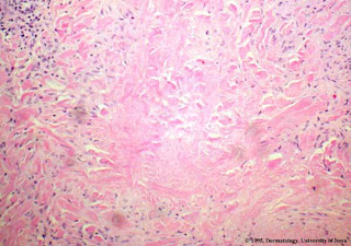 Dermapixel: abril 2011