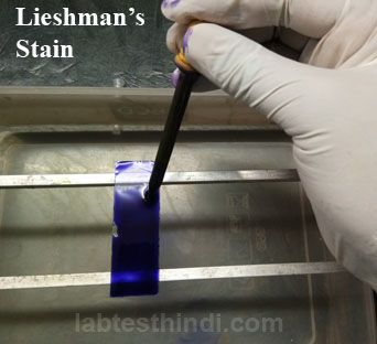 Slide Staining कैसे करते हैं – Leishman’s stain And Giemsa stain ~ Lab ...