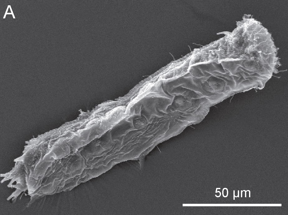 Sciency Thoughts: A new species of Gastrotrich from the coast of São ...