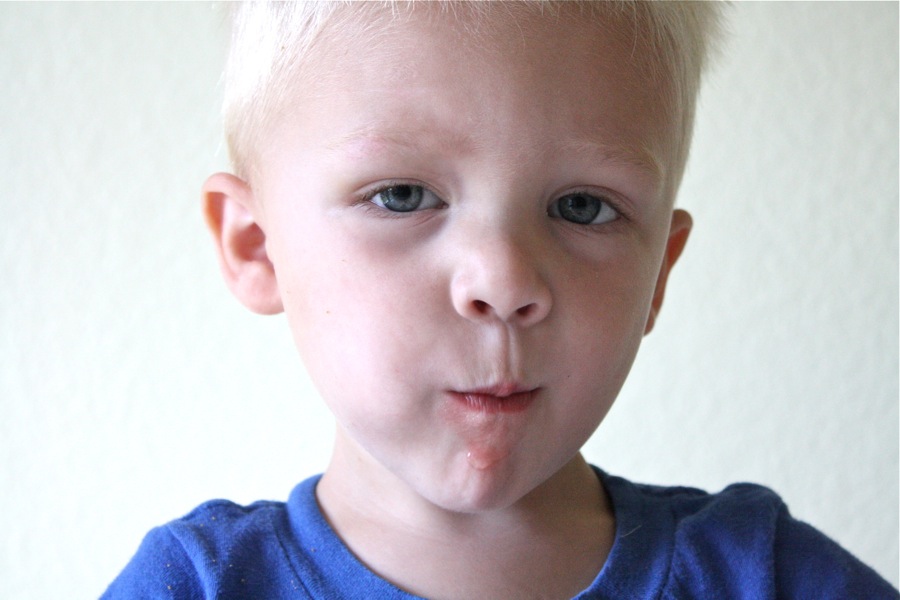 Owen, Watermelon, and that cute round head - MADE EVERYDAY