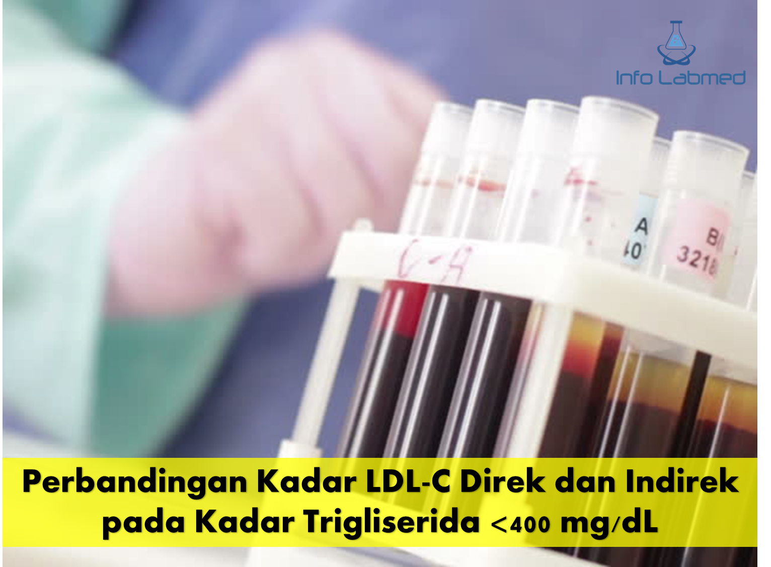 Perbandingan Kadar LDL-C Direk dan Indirek pada Kadar Trigliserida ...