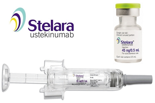 Stelara para la Psoriasis y sus Efectos Secundarios!!! | Remedios ...