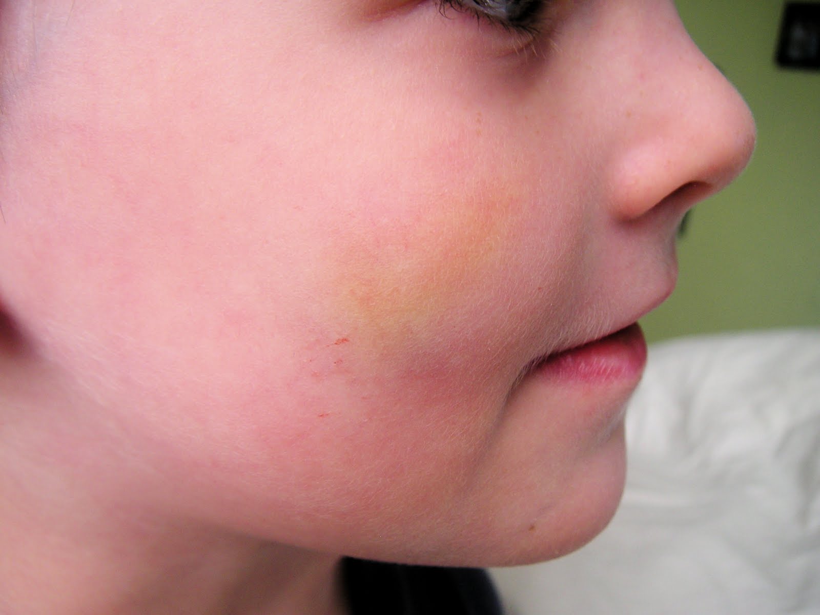 photos by amanda j: Week 22b: Bruised and Broken