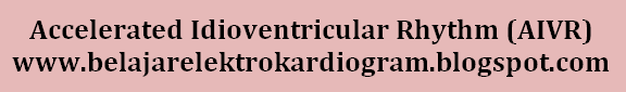 Accelerated Idioventricular Rhythm (AIVR) Atau Ritme Idioventrikular ...