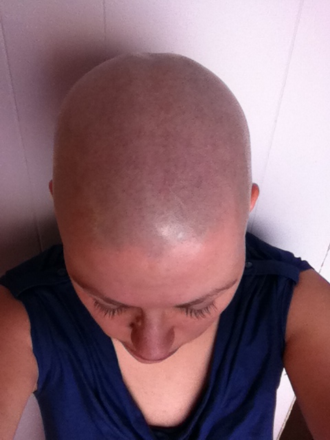 Finding My Voice: Update: My Shiny Bald Head