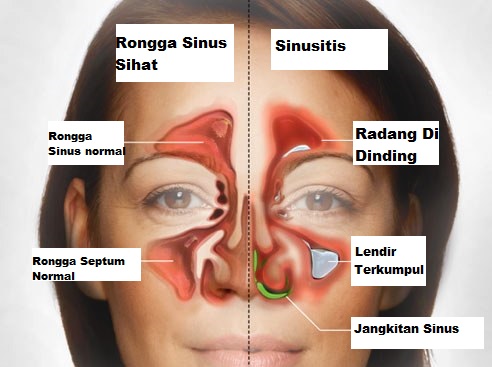 January 2018 ~ akufisio.blogspot