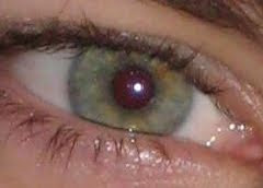 World Of Technology: The rarest eye colors in humans – red eye occurs ...