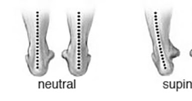 Life Is a Tango: Twenty Tango Lessons: Part 12: Proper foot care is a ...