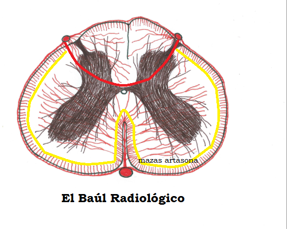 El Baúl Radiológico: EDEMA DE LA MÉDULA ESPINAL: HALLAZGOS EN IRM ...