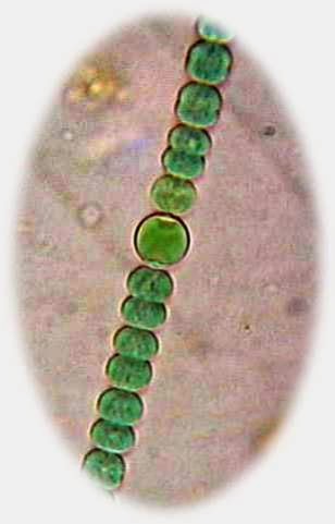 Microbiología: Cianobacterias