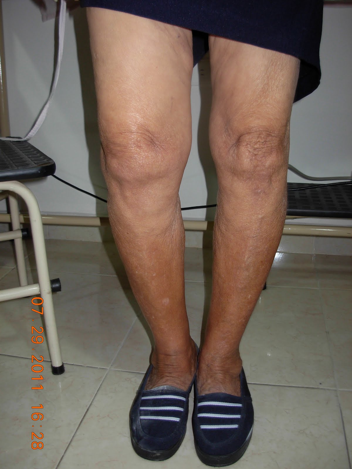 Luz Maria Salazar J. Medicina Biologica Integrativa: ARTROSIS DE ...