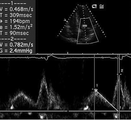 Dr Han Naung @ Henry Han : Electrophysiology and Heart Rhythm ...