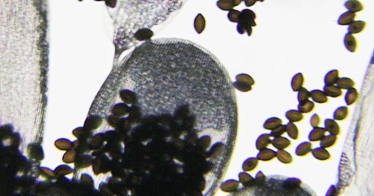 Microscope World Blog: Protozoan Parasite under the Microscope