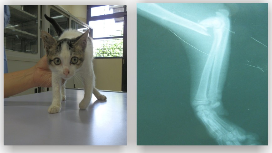 Junto Julianto: FRAKTUR OS. HUMERUS