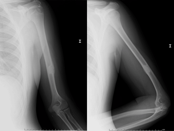 Reumails. Reumatología al día: Diagnóstico Diferencial de Lesiones ...