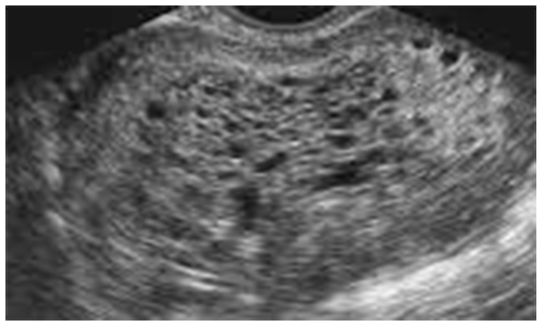 Penyebab Dan Apa Itu Hamil Anggur. - Kantong Obat.