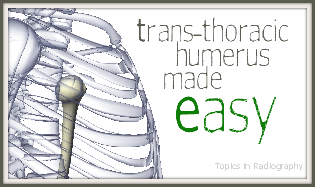 Topics in Radiography: Trans-thoracic Humerus Made Easy