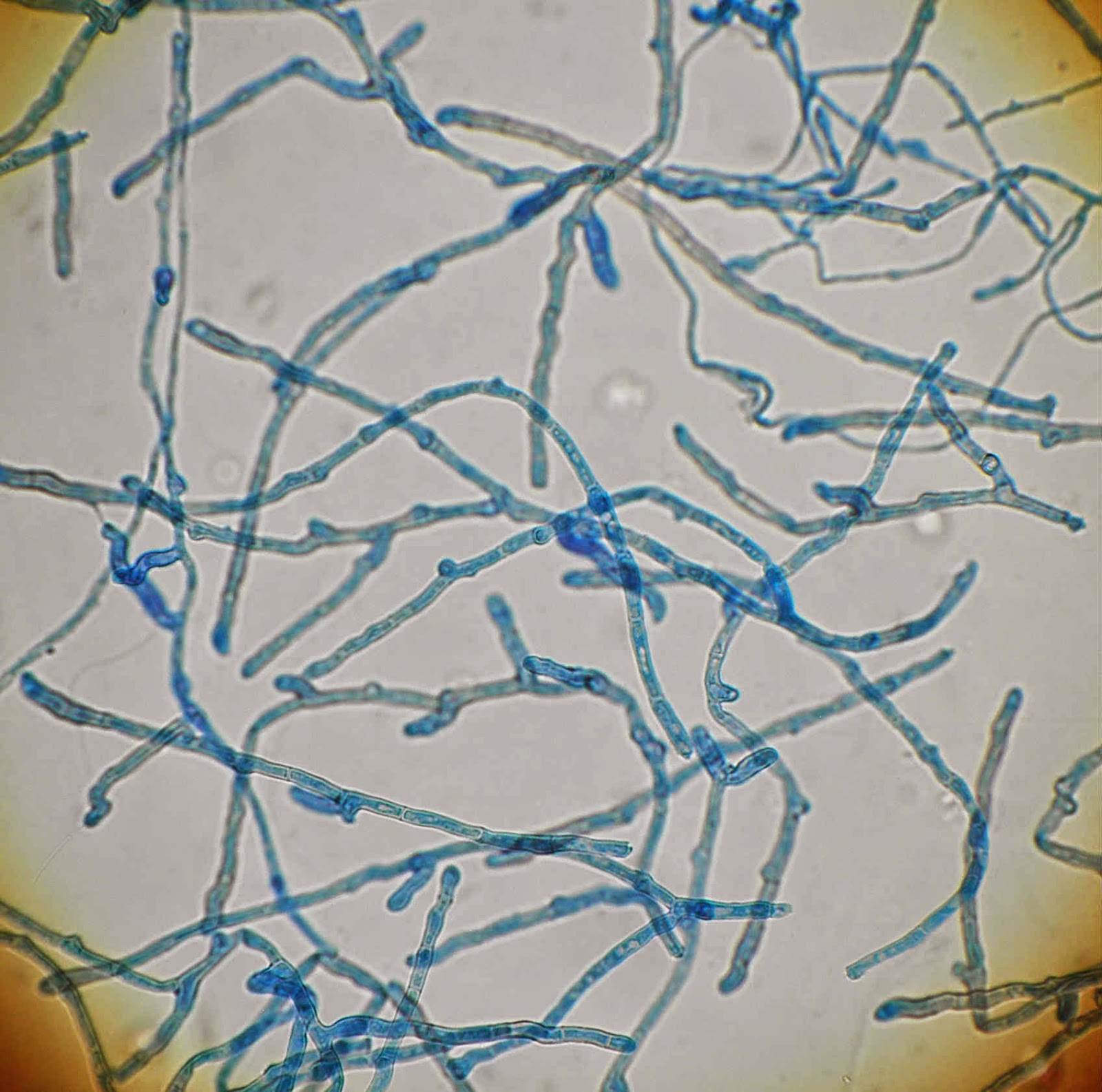 ATLAS MICOLOGIA: EXSEROHILUM ROSTRATUM