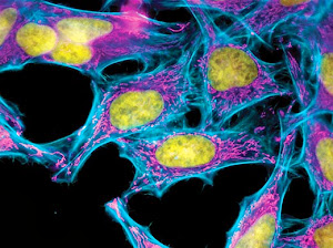 The Immortal Life of Henrietta Lacks: What factors (race, class, gender ...