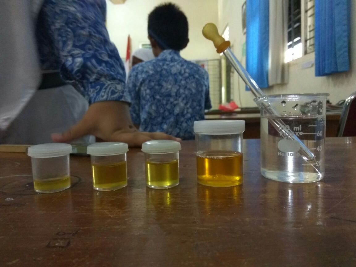 Shed a Glimmer of Insight: Praktikum Uji Urin