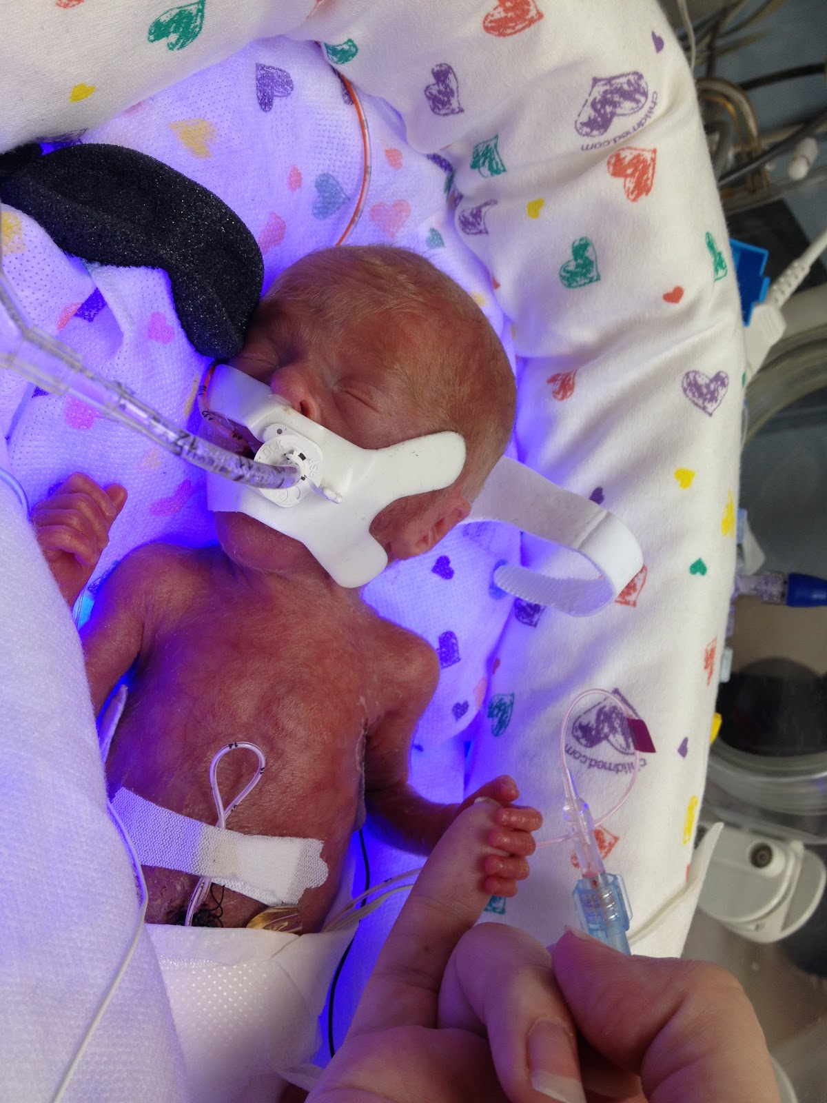 Connor Twins: 26 weeks old today!