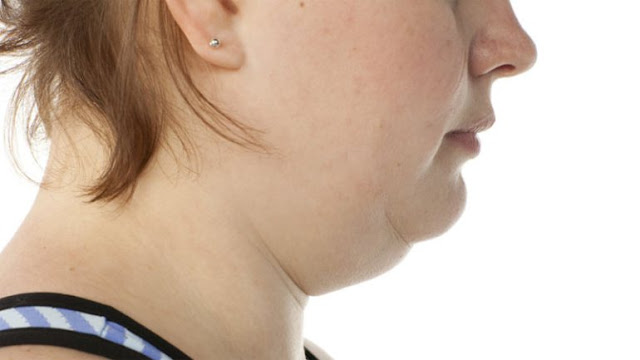 It's How To Eliminate Fat In The Neck - The Ceilings