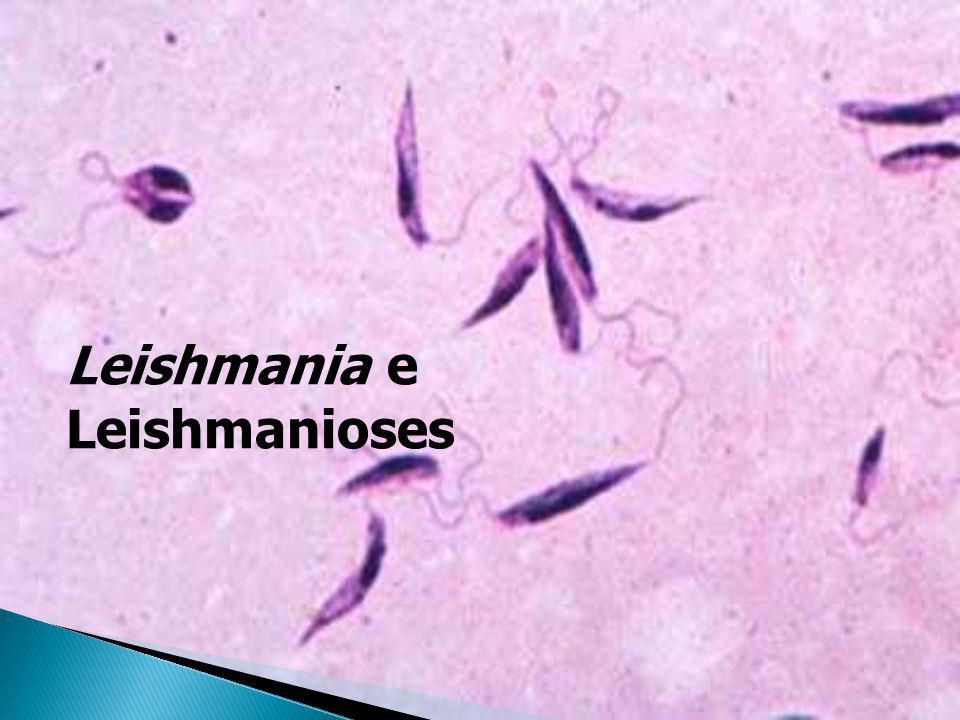 Leishmania e Leishmaniose - Análises Clínicas.com