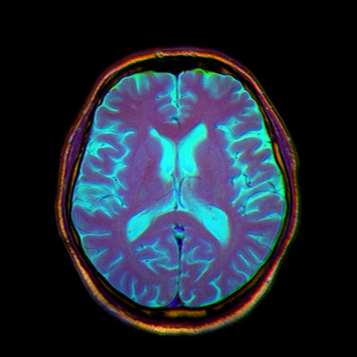 Nevit's blog: Color MRI of the Brain