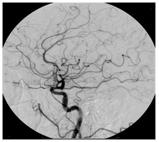 Warungbocah7: Tata Cara Pemeriksaan Angiografi