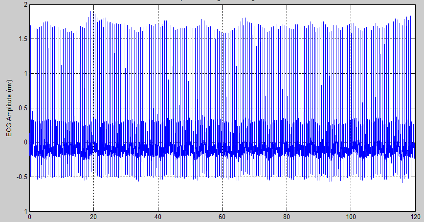 Biomedical Signal and Image Processing projects using Matlab and ...
